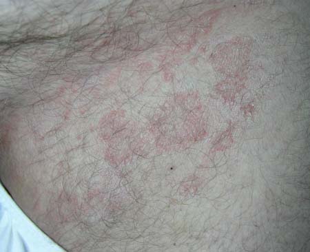 Δερματολογικά Νοσήματα – Δερματολόγος / Αφροδισιολόγος | Εφαρμογές Laser