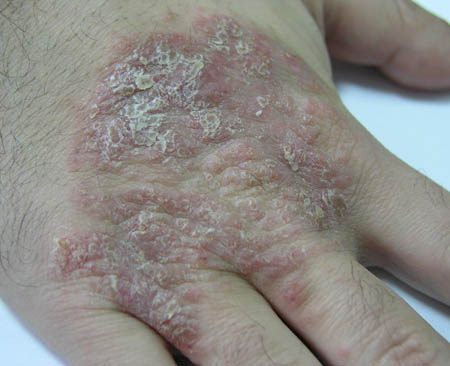 Δερματολογικά Νοσήματα – Δερματολόγος / Αφροδισιολόγος | Εφαρμογές Laser